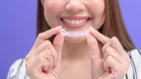 Clear Aligner Therapy • Mabry Family Dentistry